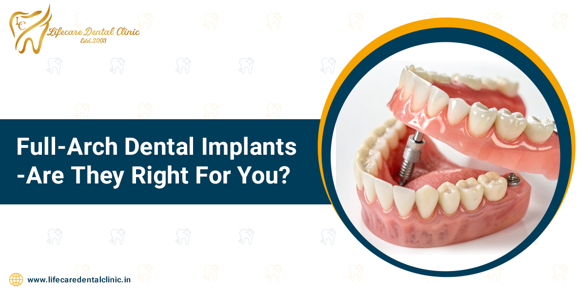 Explore Dental Blog with Tips, Facts & Advice | Lifecare